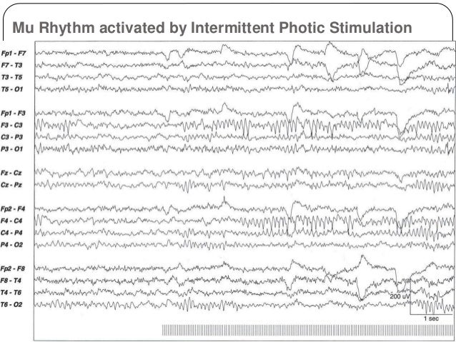 Mu rhythm
