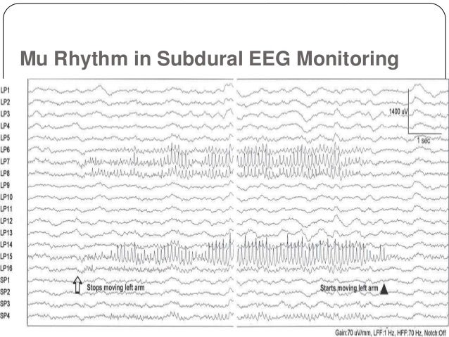 Mu rhythm