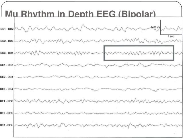 Mu rhythm