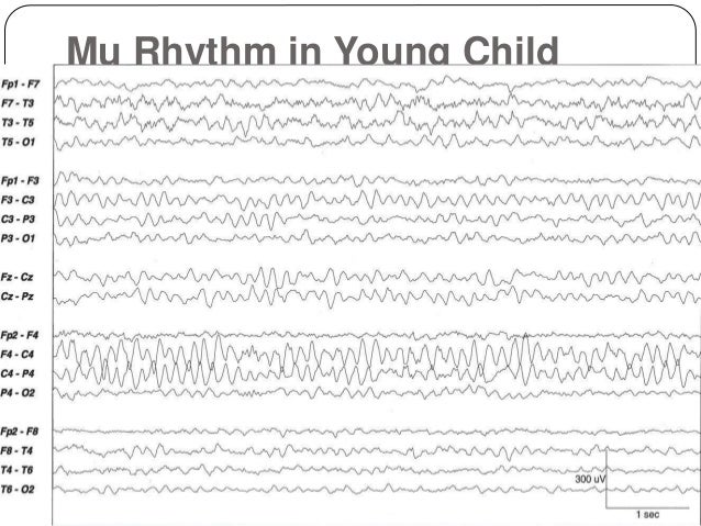Mu rhythm