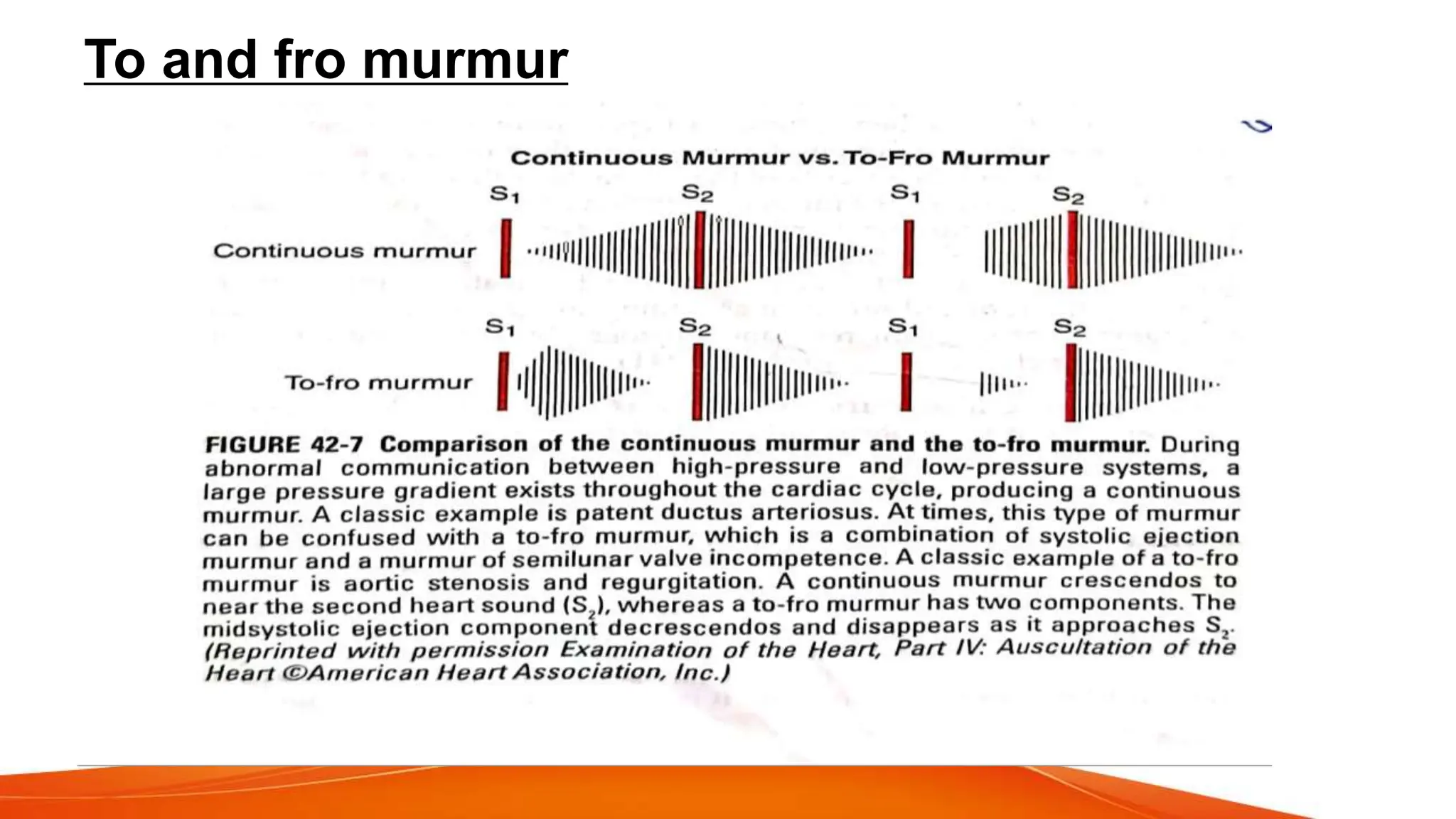 MURMUR Cardio vascular system ready.pptx