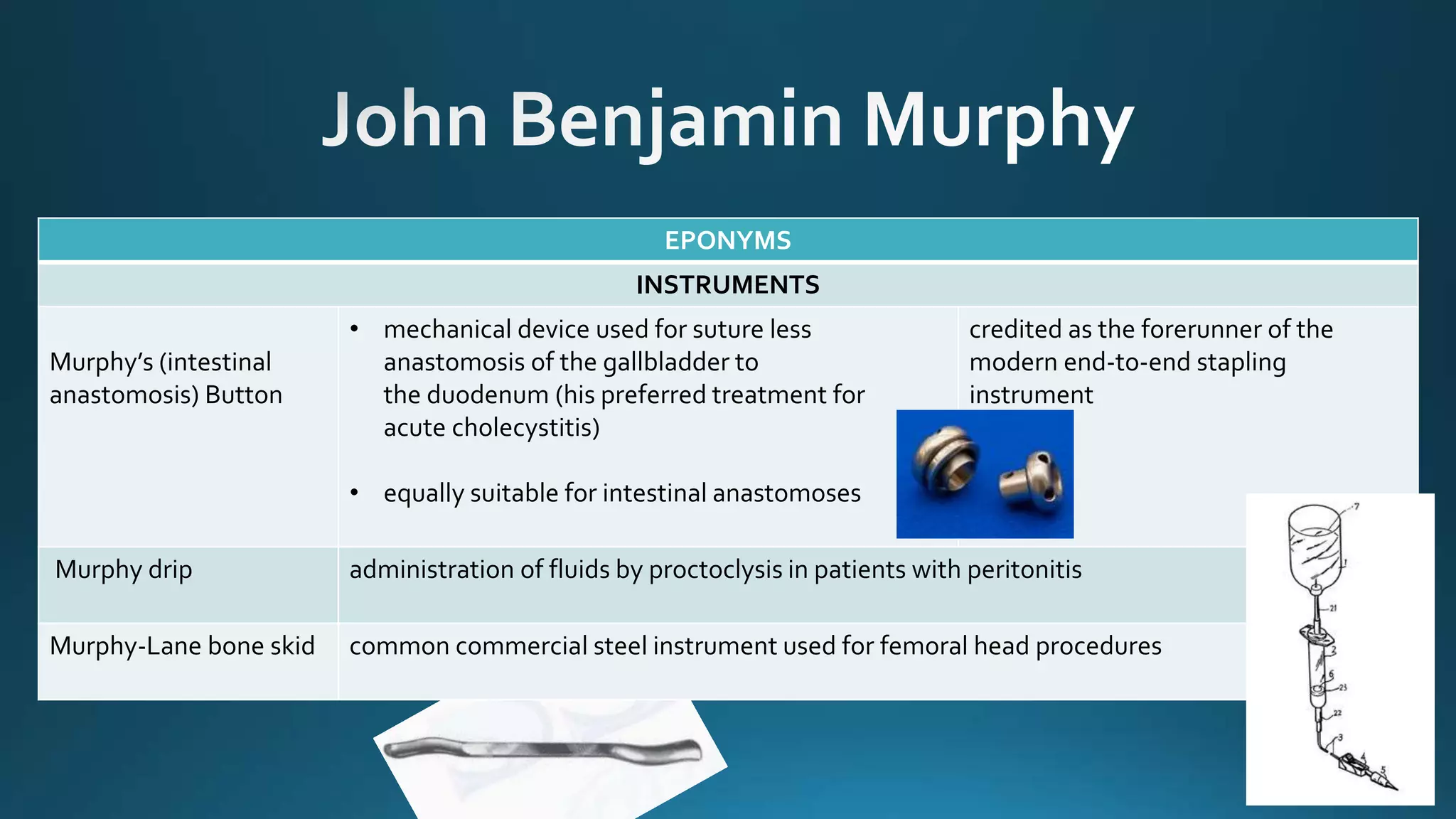 MURPHY'S SIGN of cholecystitis/gallbladder: sign of acute or chronic ...