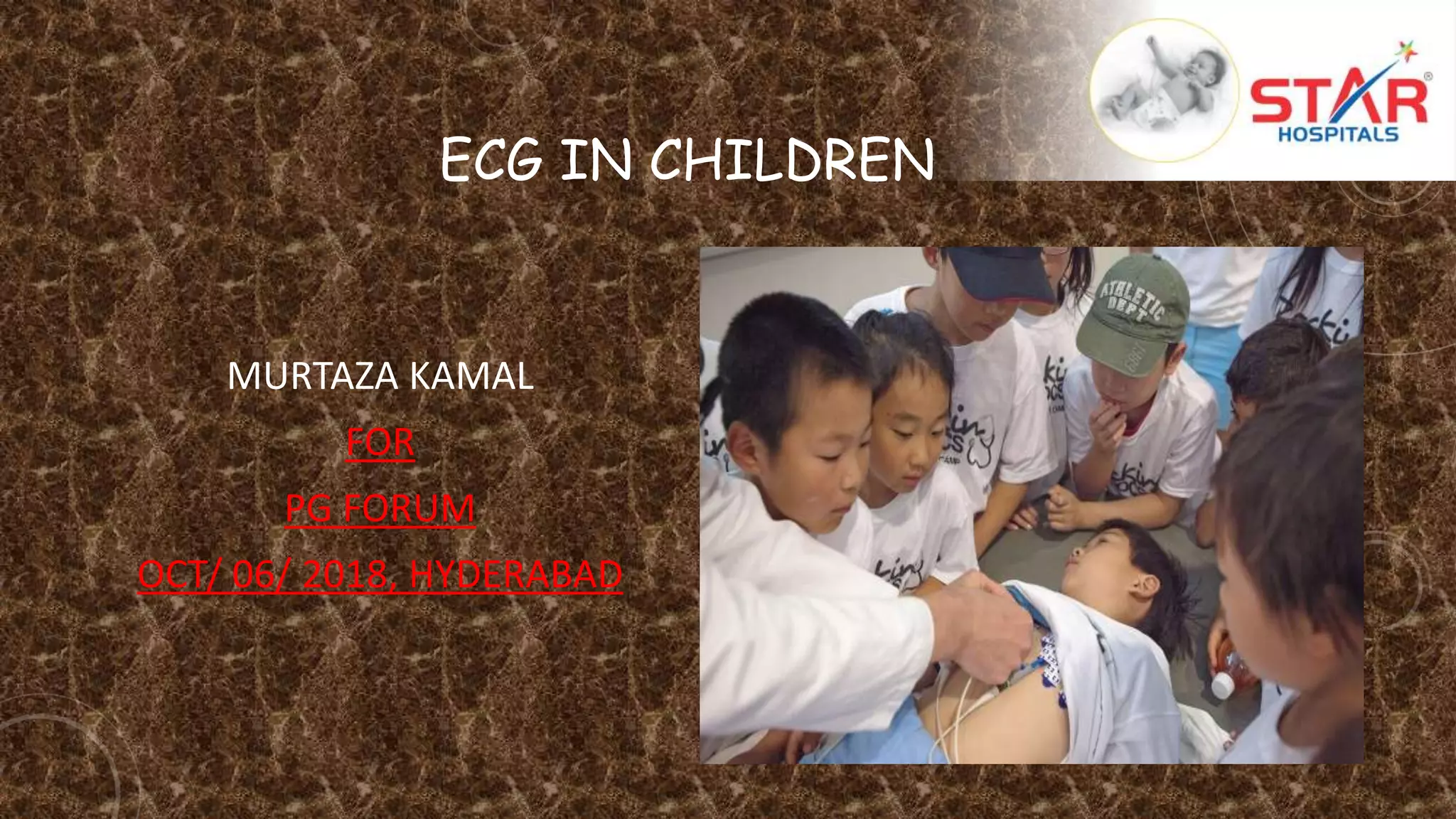 PEDIATRIC ECG, ECG IN CONGENITAL HEART DISEASES | PPTX