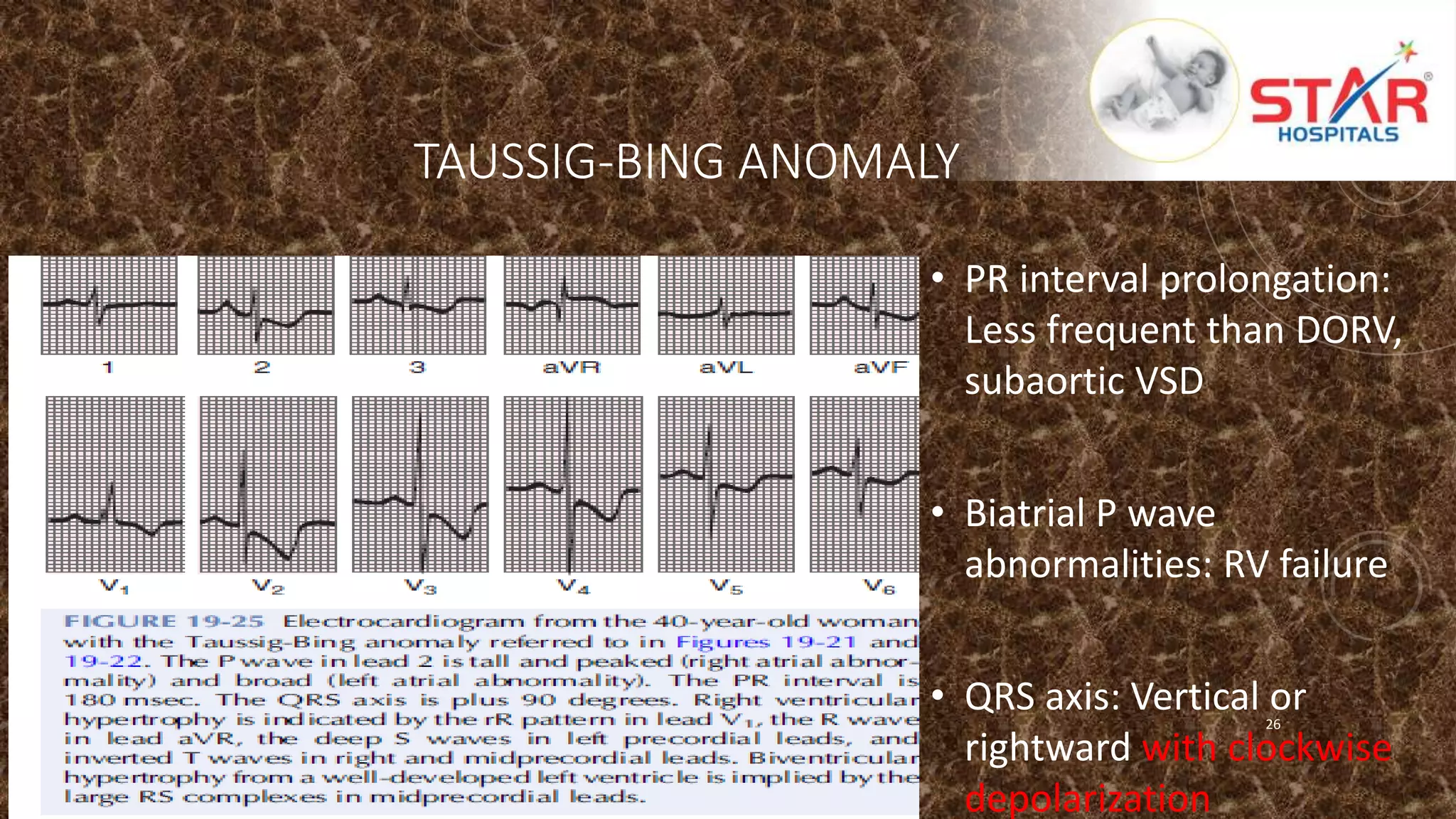 PEDIATRIC ECG, ECG IN CONGENITAL HEART DISEASES | PPTX