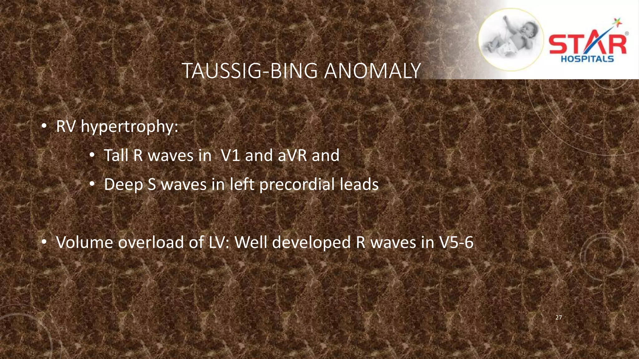 PEDIATRIC ECG, ECG IN CONGENITAL HEART DISEASES | PPTX