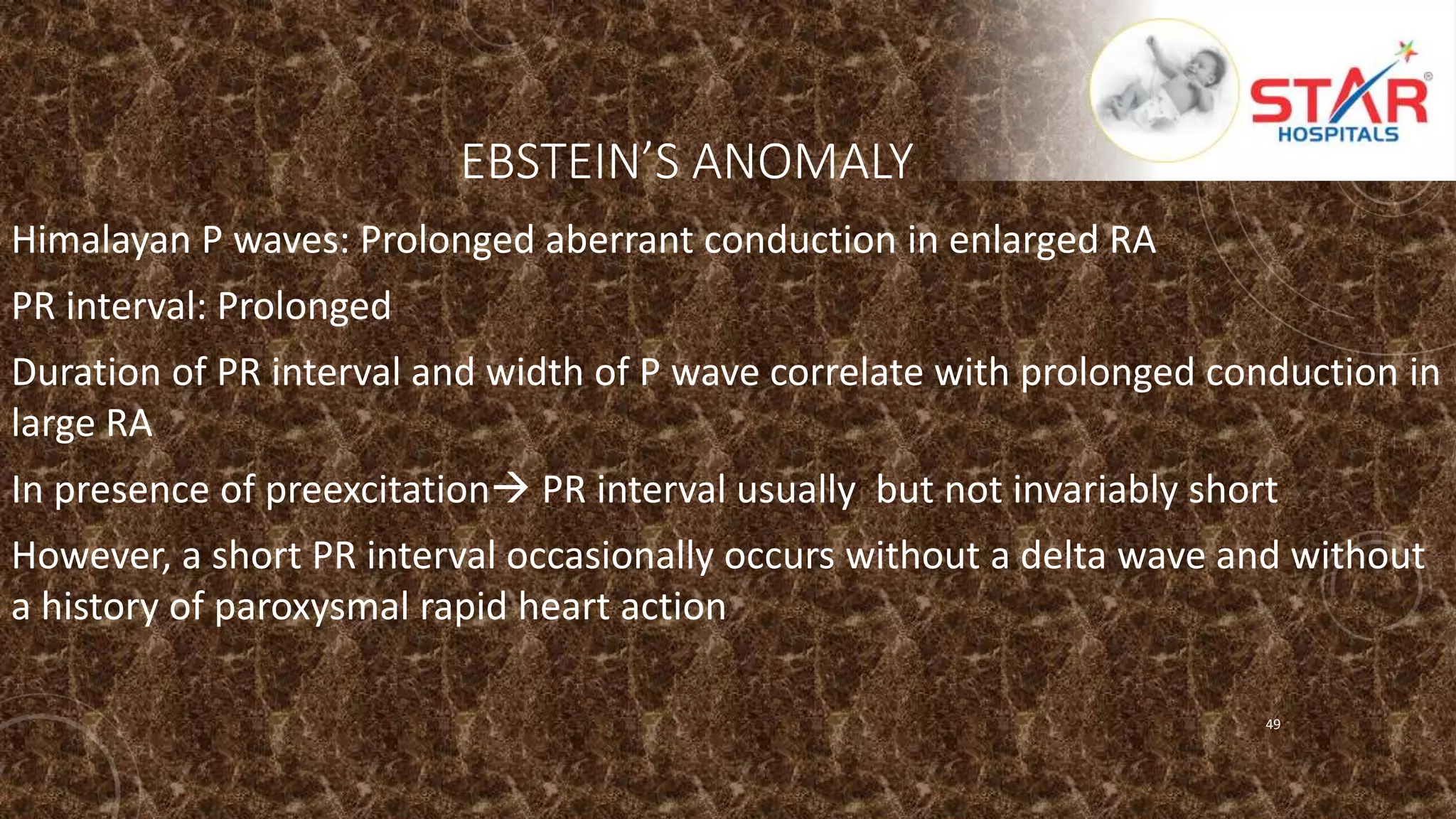 PEDIATRIC ECG, ECG IN CONGENITAL HEART DISEASES | PPTX