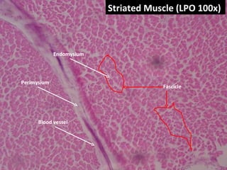 Skeletal Muscle Tissue Slide 100x
