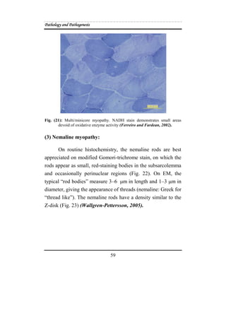 Thesis section: The role of neuroimaging in muscle and peripheral nerve ...