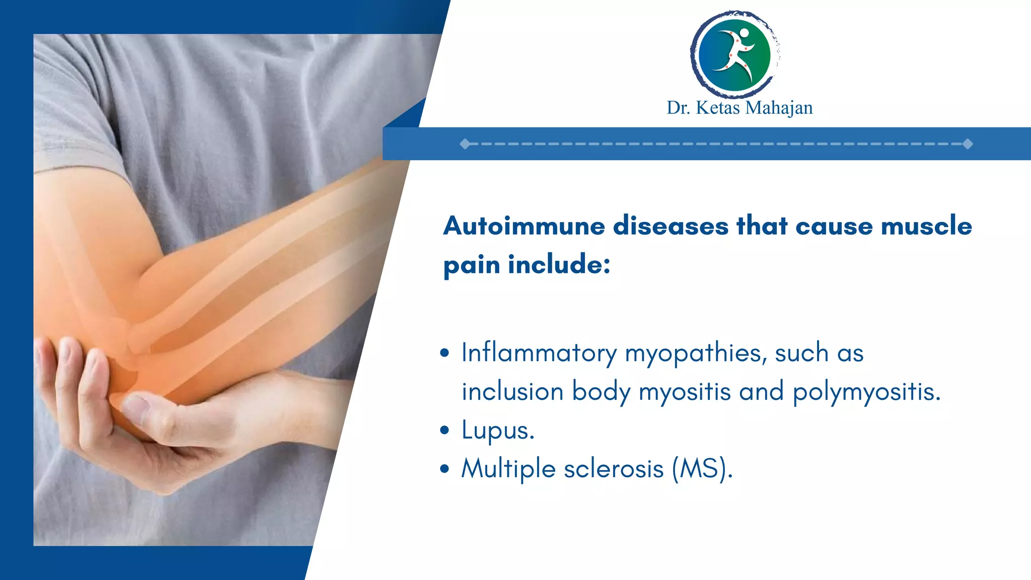 Muscle Pain | Muscle Pain Treatment in Vadodara | PPT