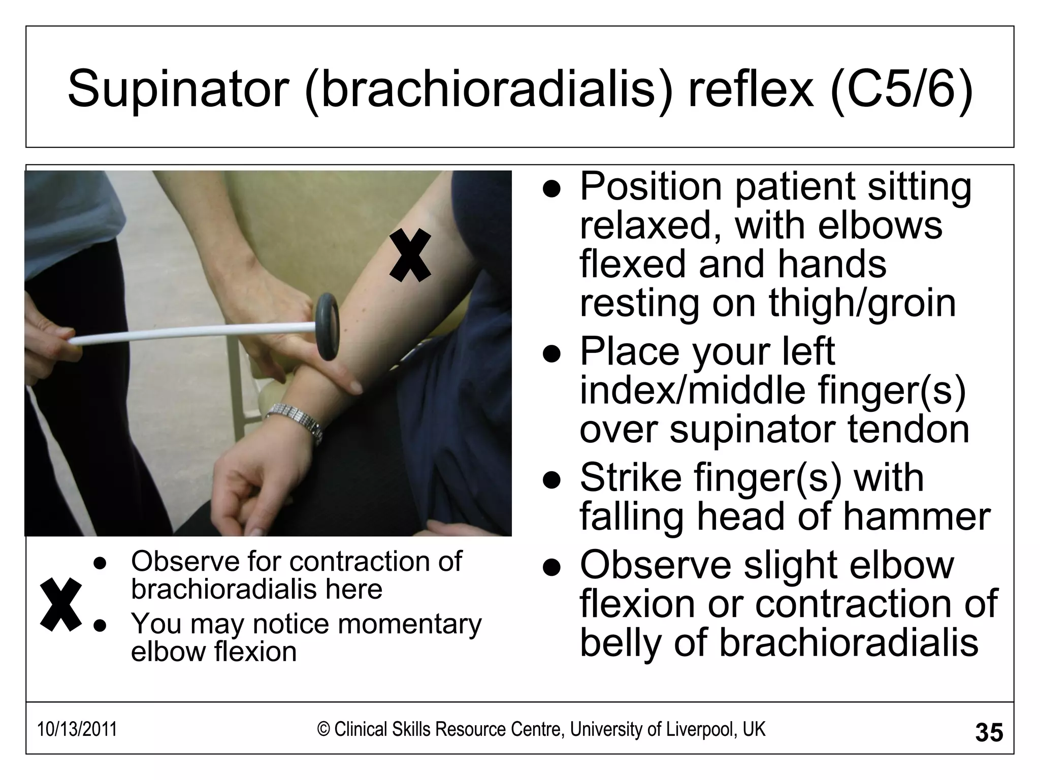 Muscle Power and Tone Examination | PDF