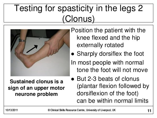 Muscle Power and Tone Examination