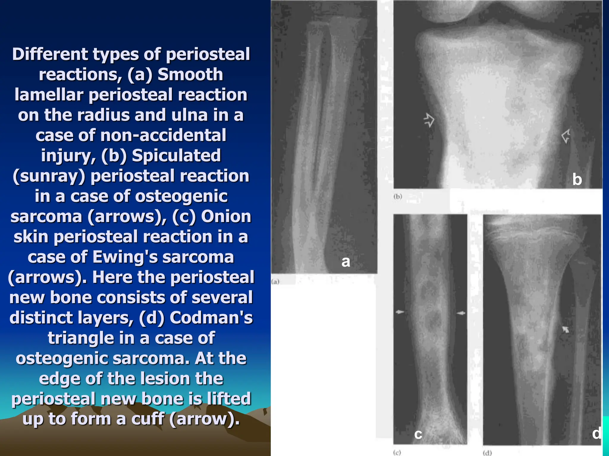 muscle-sceletal system. Radiological examinations ppt | PPT | Death ...