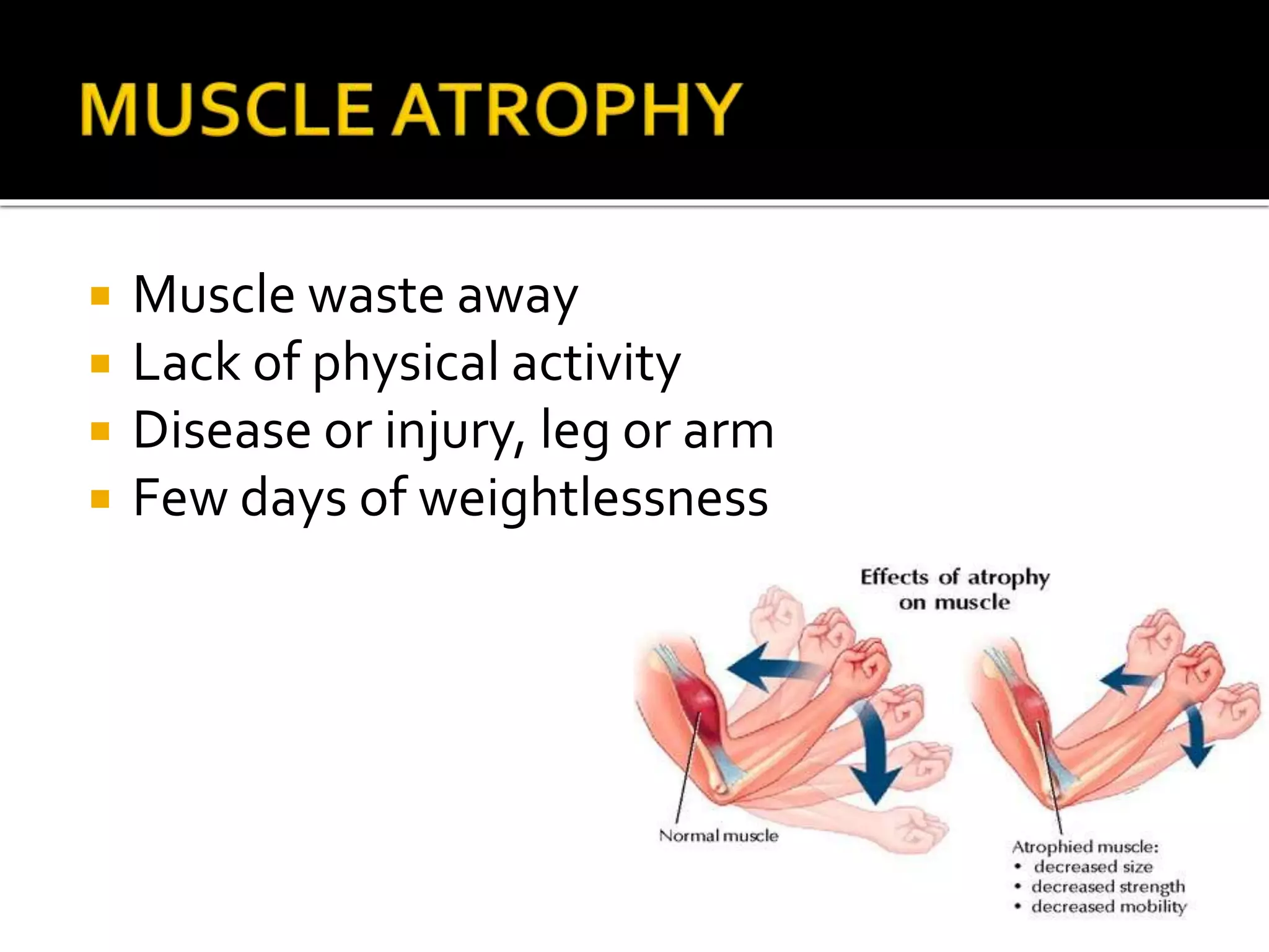 Muscle Atrophy on Astronauts | PPT