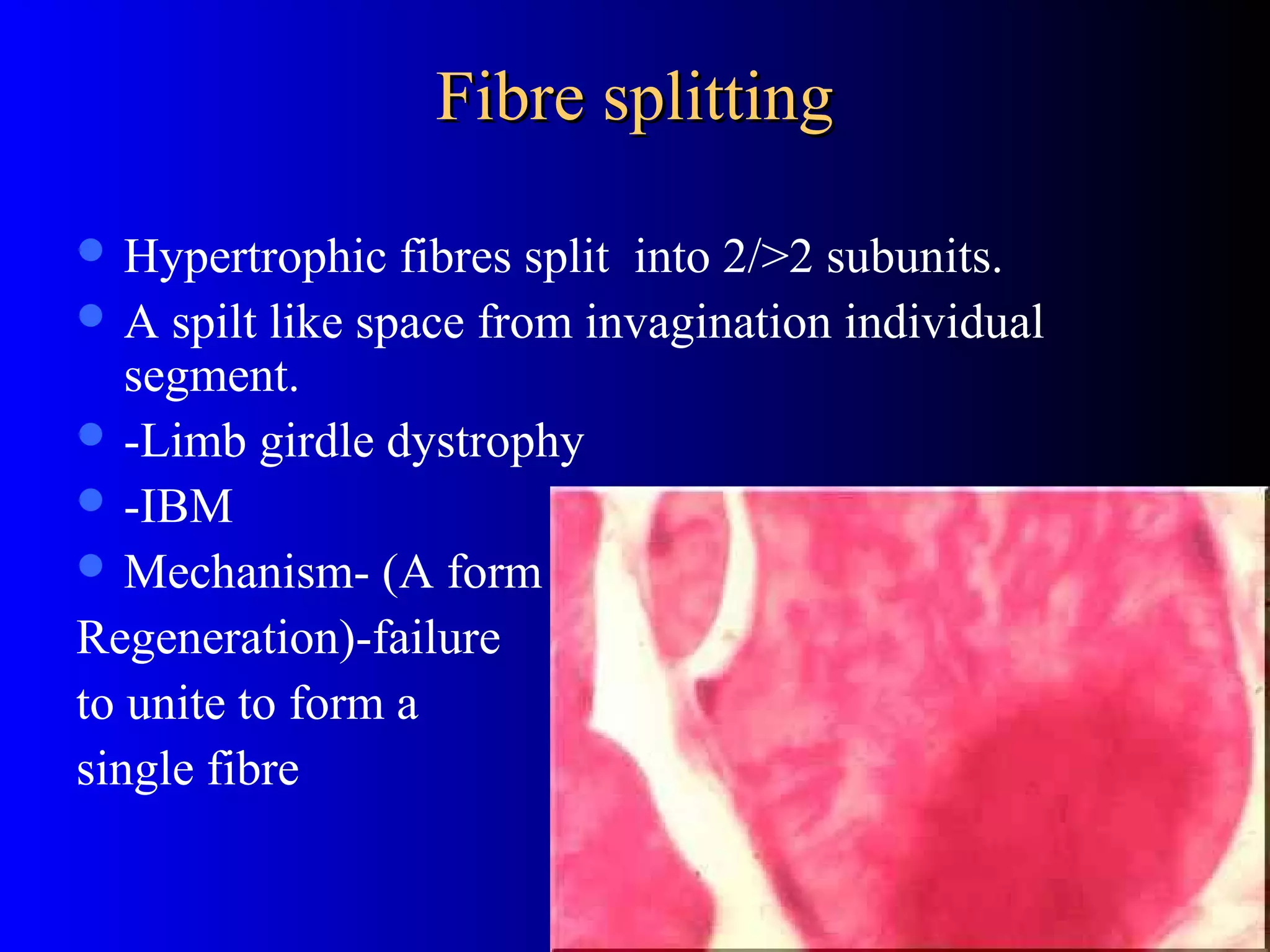 Muscle biopsy | PPT