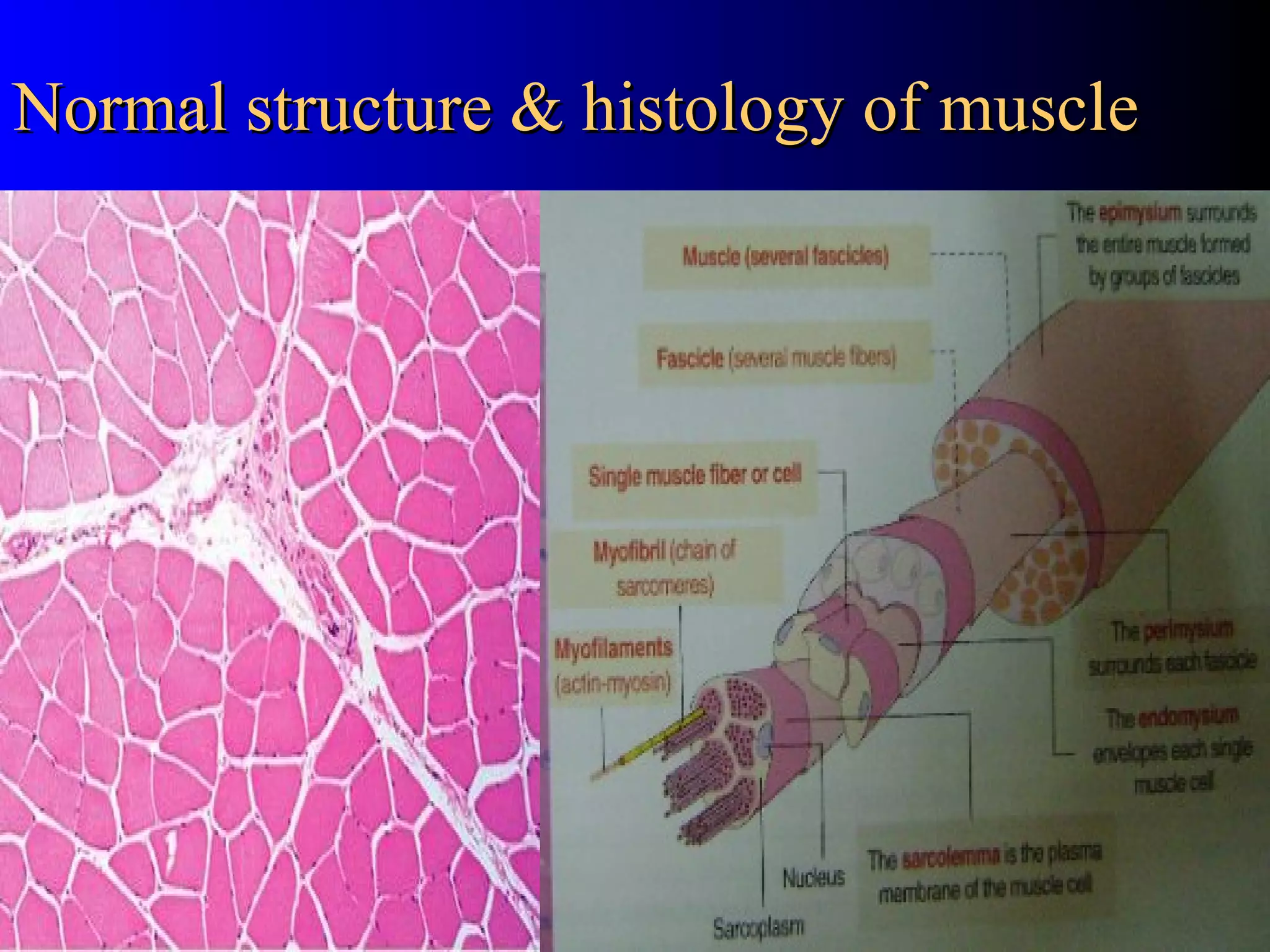 Muscle biopsy | PPT