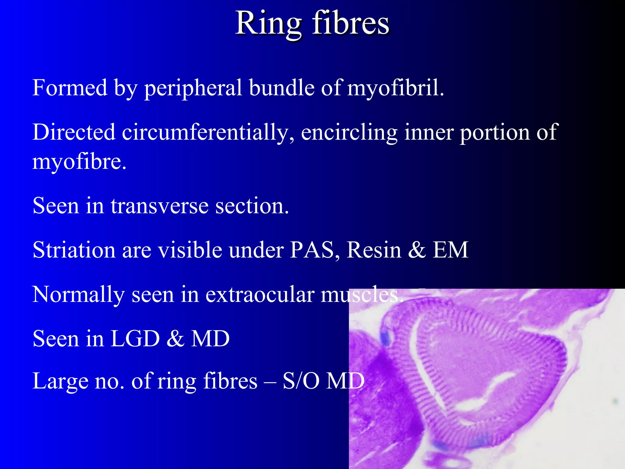 Muscle biopsy | PPT