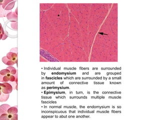 Muscle biopsy adrija | PPTX
