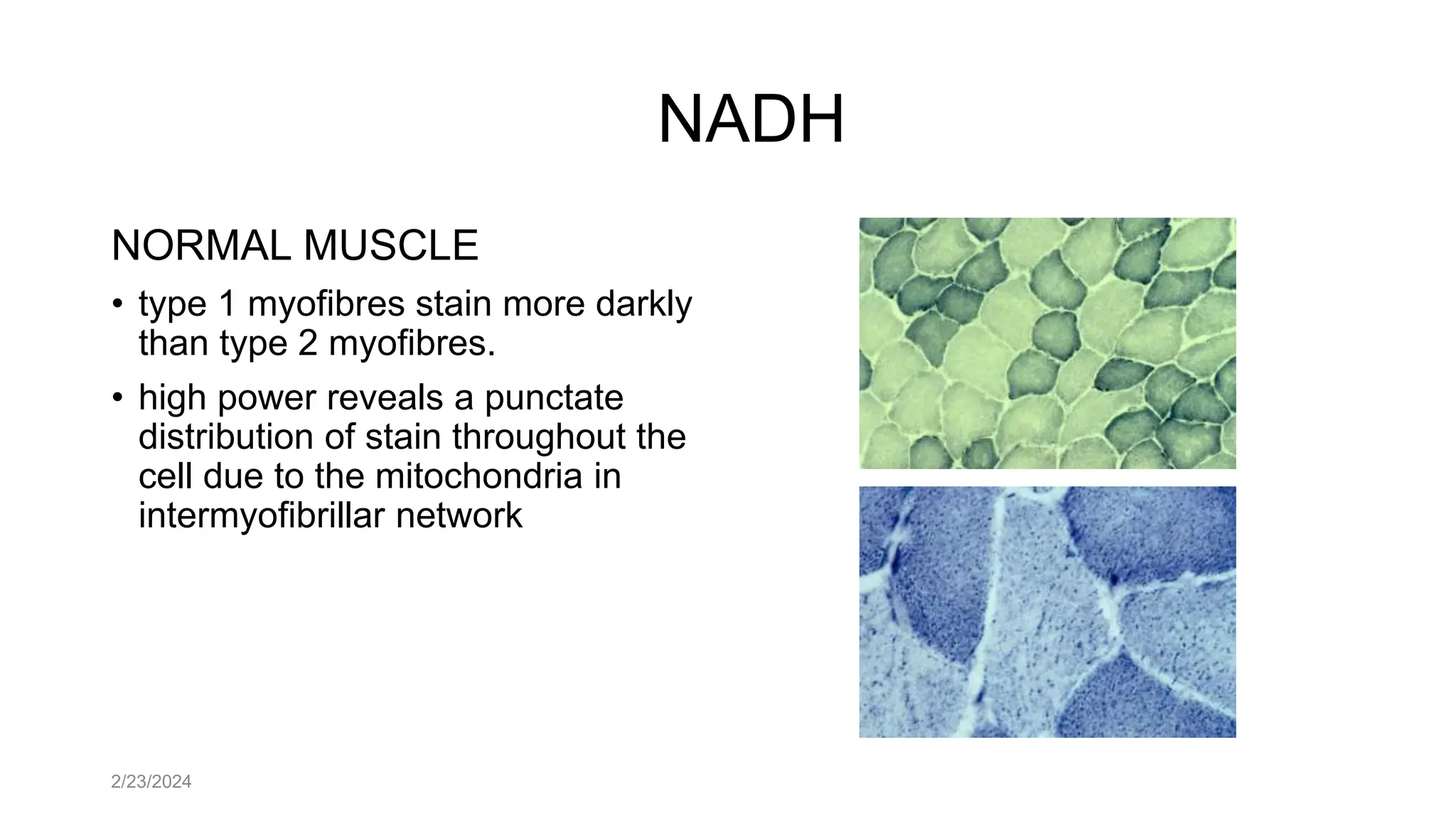 muscle biopsy (3).ppt, diagnosis, types, biopsy | PPT