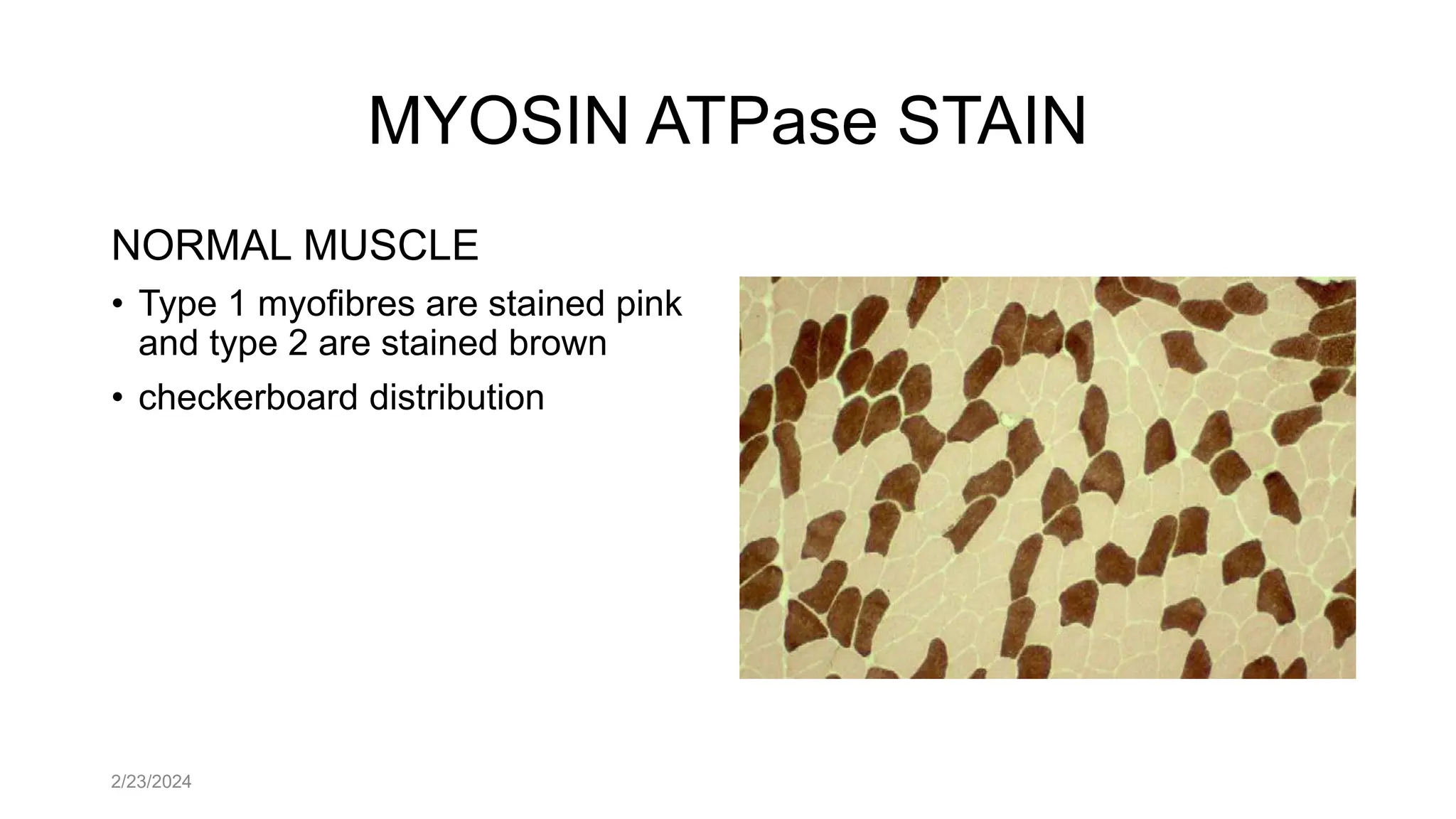 muscle biopsy (3).ppt, diagnosis, types, biopsy | PPT