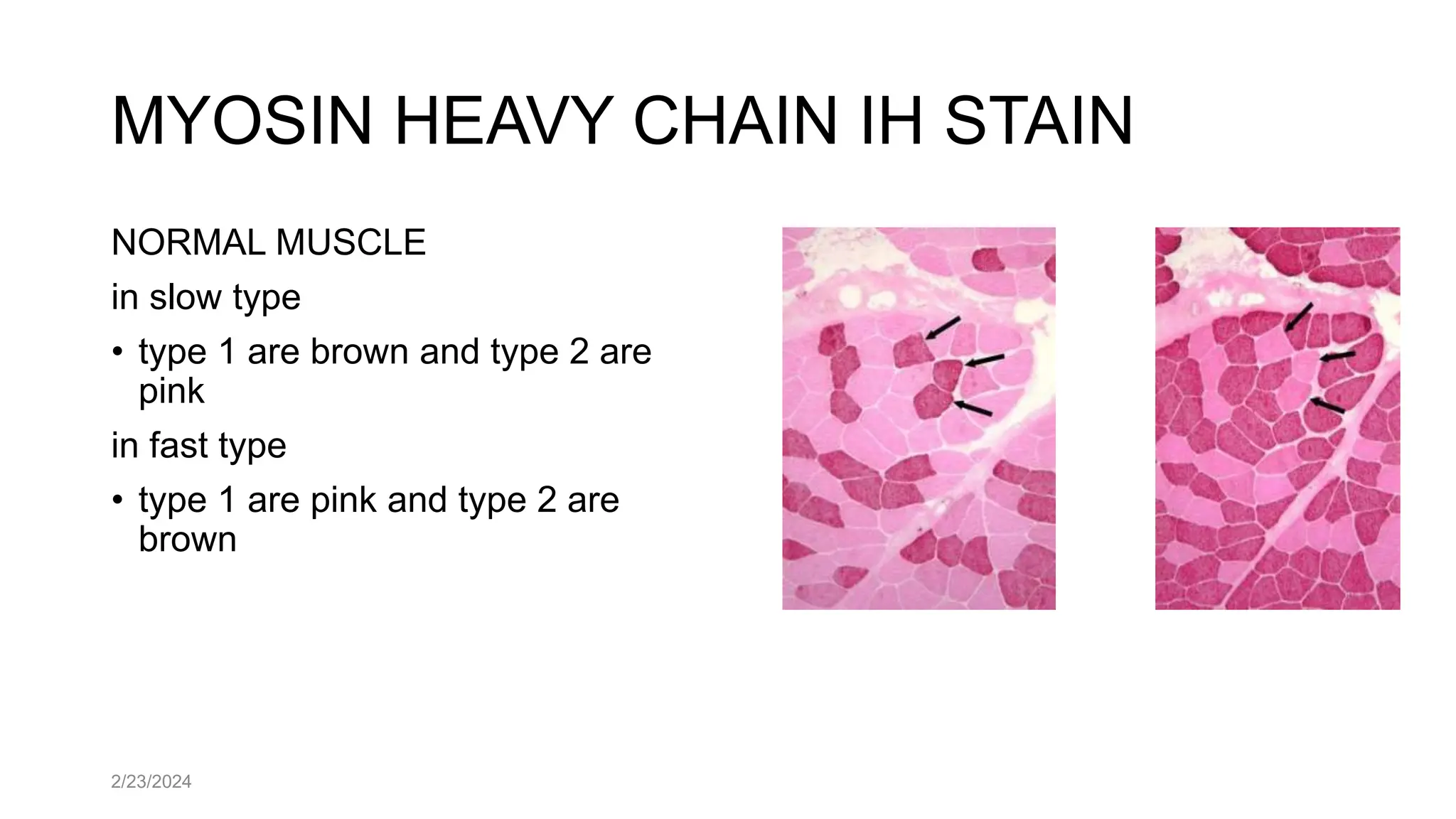 muscle biopsy (3).ppt, diagnosis, types, biopsy | PPT