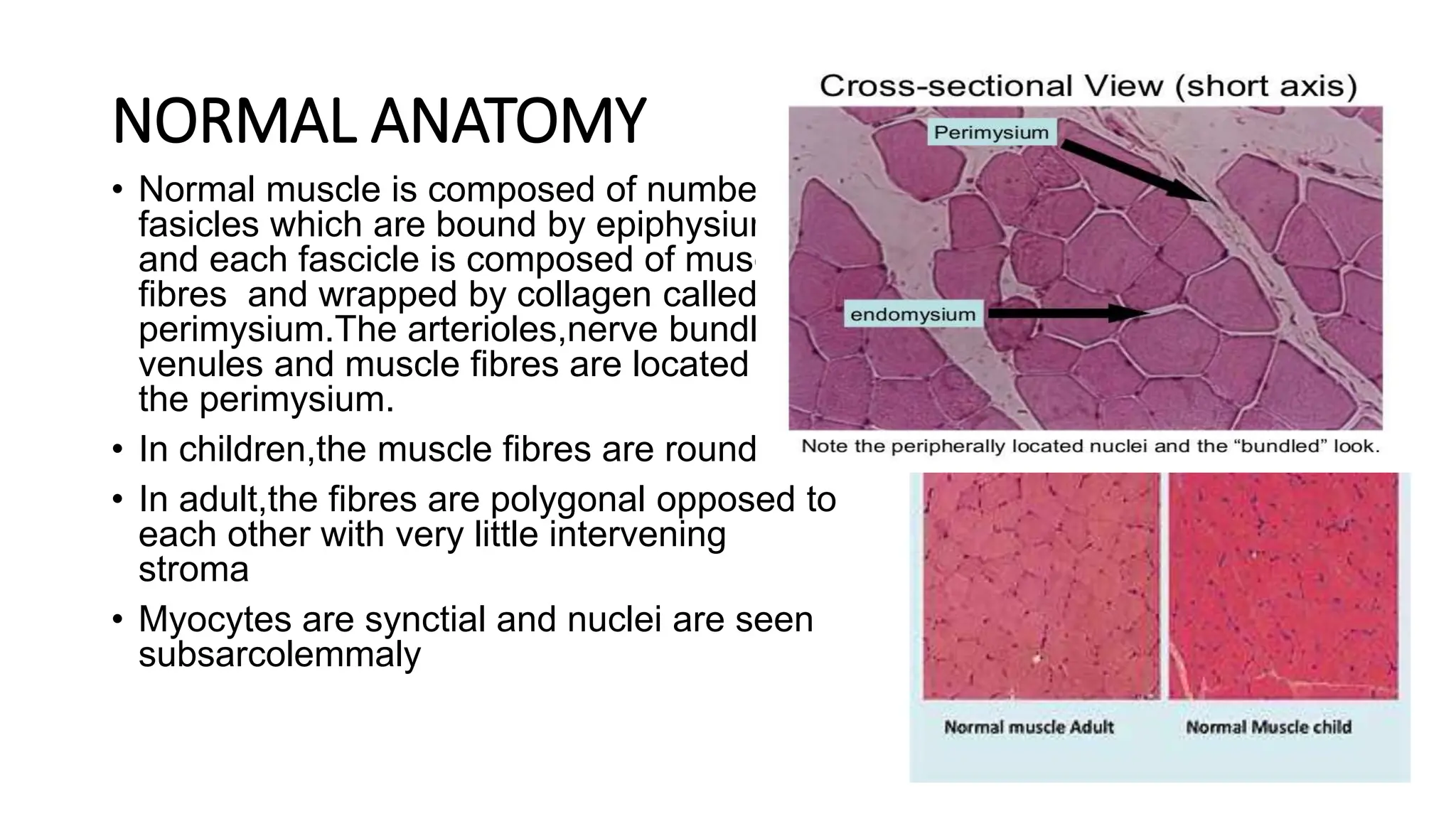 muscle biopsy (3).ppt, diagnosis, types, biopsy | PPT