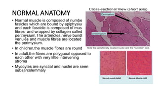 muscle biopsy (3).ppt, diagnosis, types, biopsy | PPT