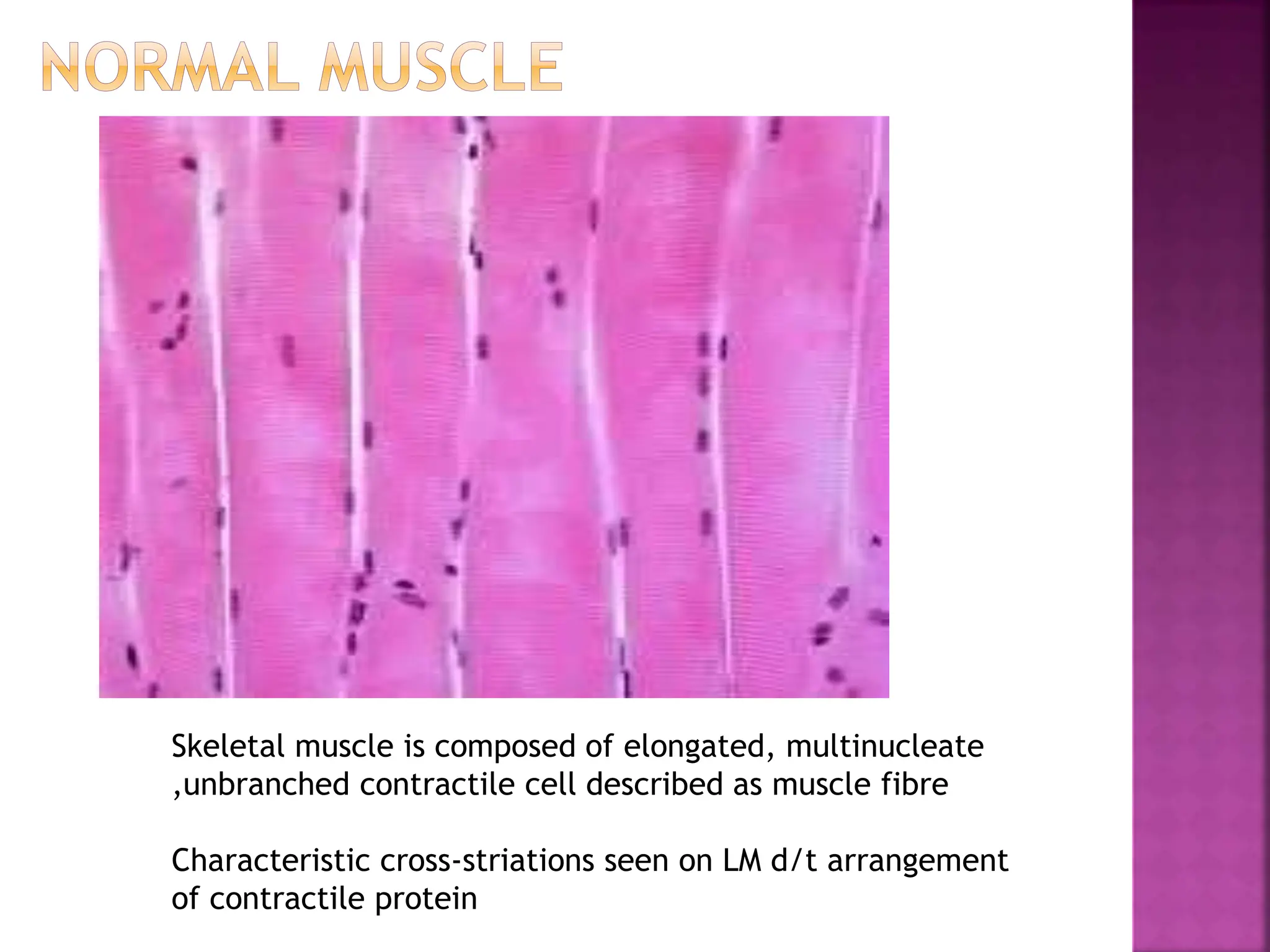 muscle biopsy site indications staining processing of muscle biopsy.pptx
