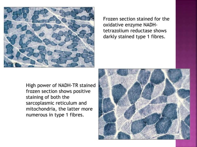 muscle biopsy site indications staining processing of muscle biopsy.pptx