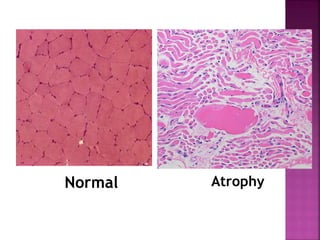 muscle biopsy site indications staining processing of muscle biopsy.pptx