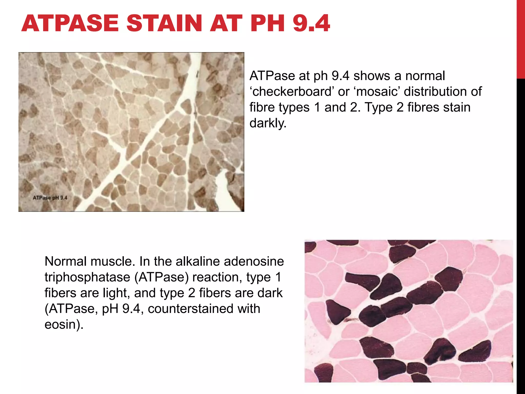 Muscle biopsy –INDICATIONS, processing and morphology.pptx