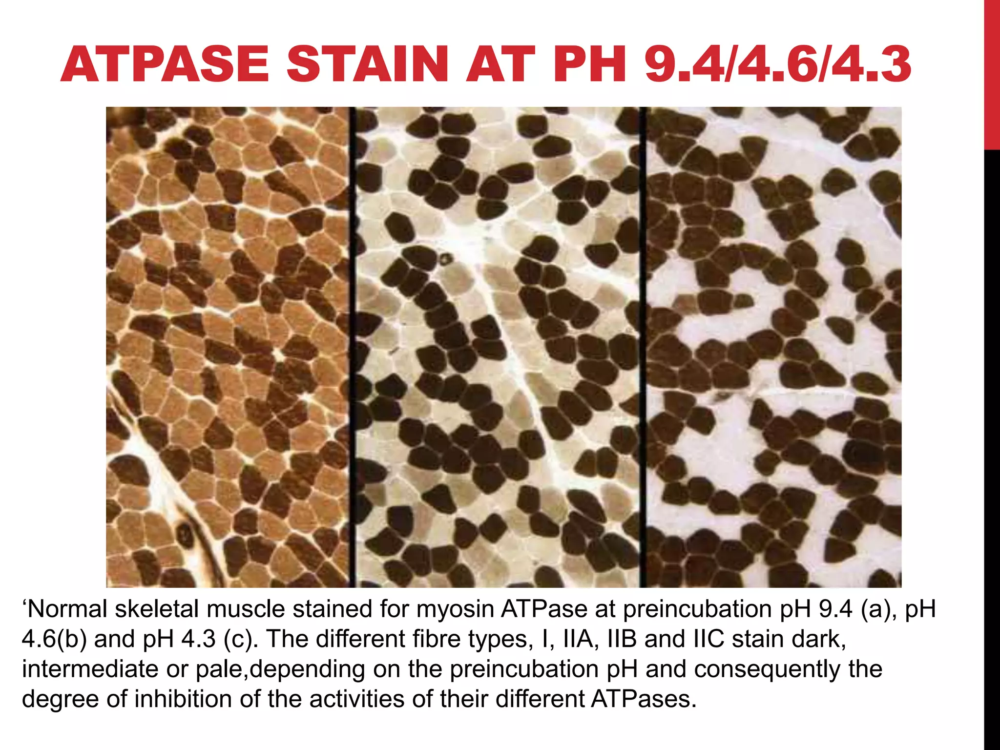 Muscle biopsy –INDICATIONS, processing and morphology.pptx