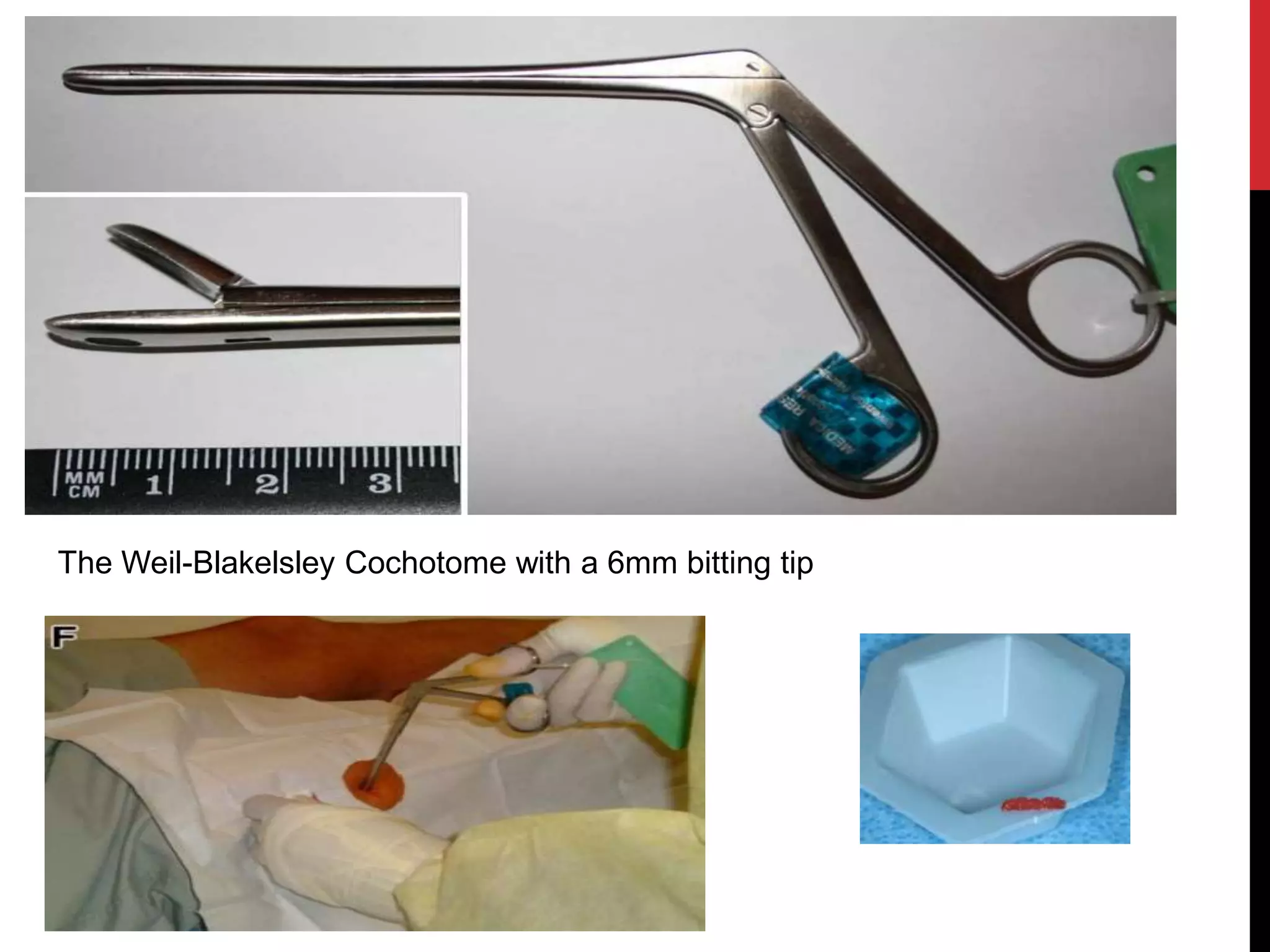 Muscle biopsy –INDICATIONS, processing and morphology.pptx