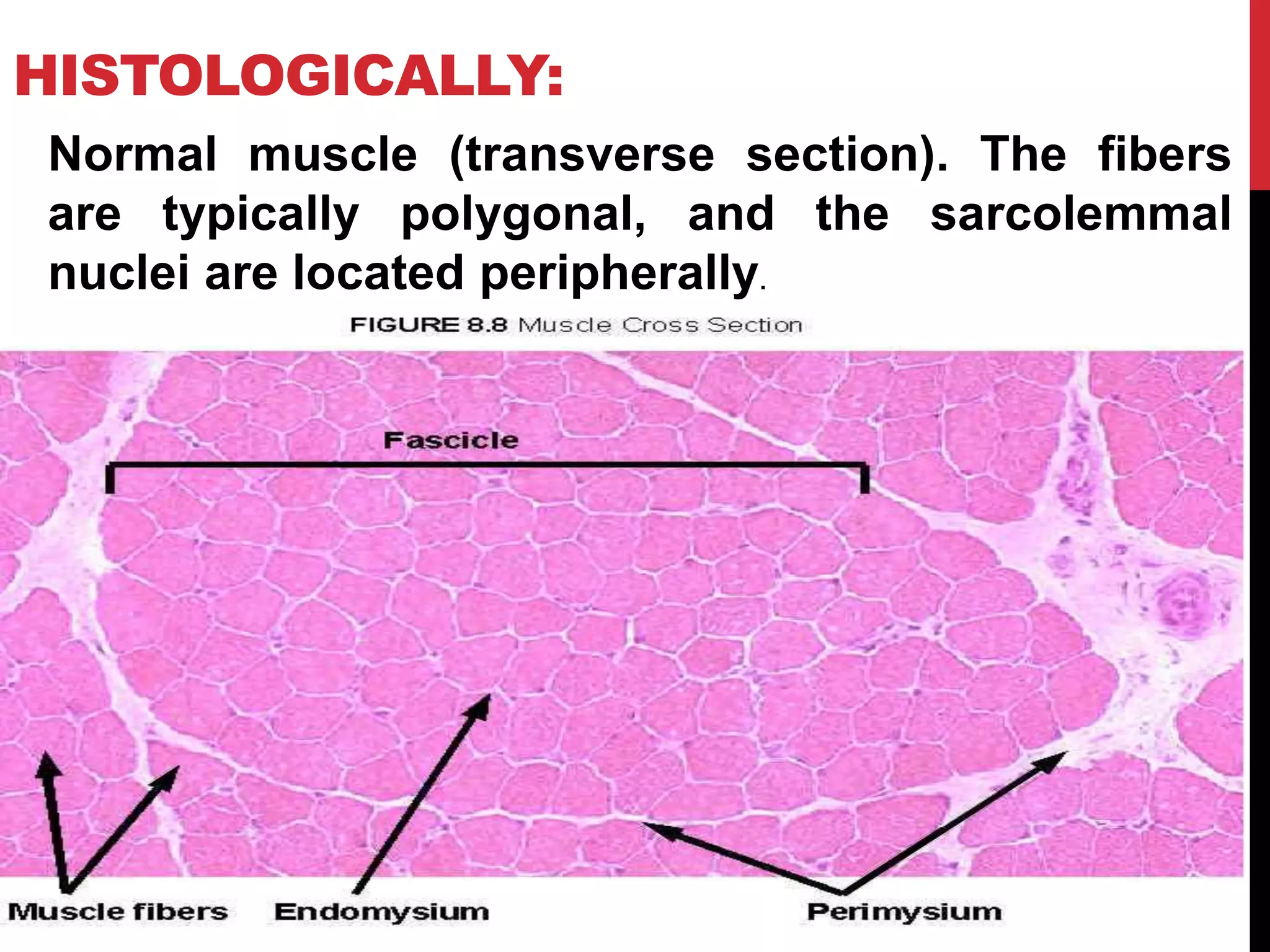 Muscle biopsy –INDICATIONS, processing and morphology.pptx