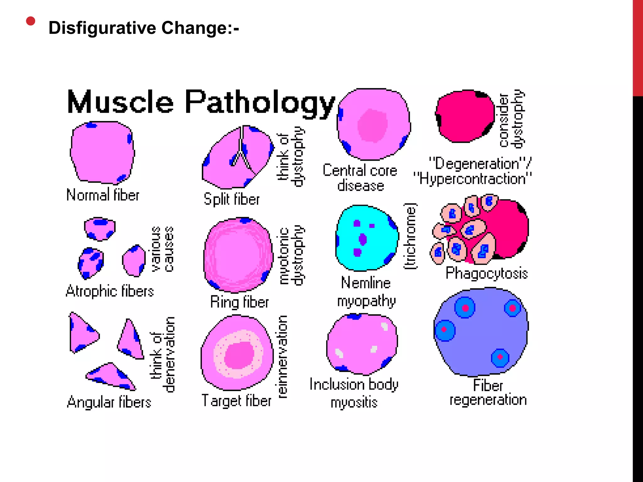Muscle biopsy –INDICATIONS, processing and morphology.pptx