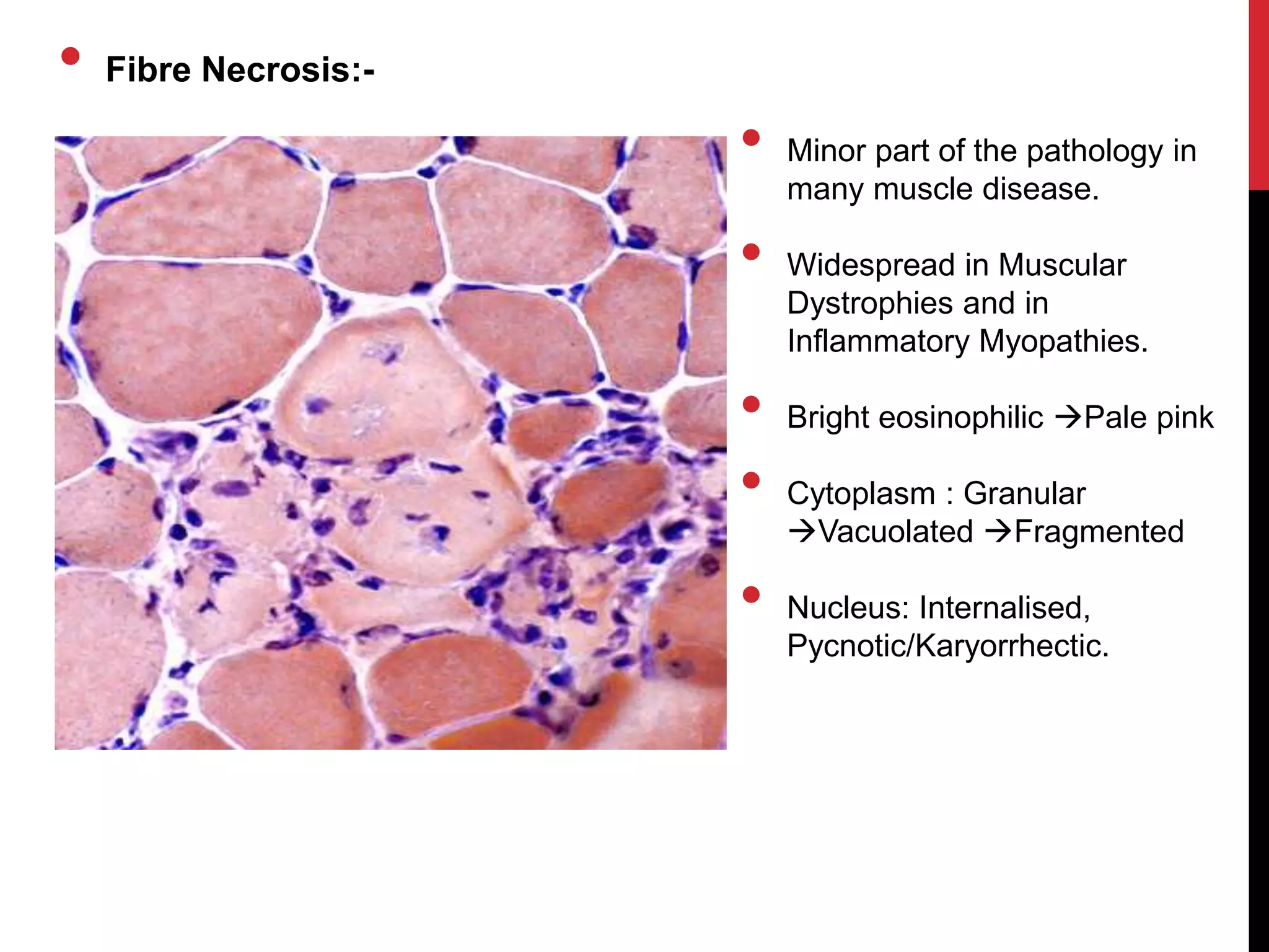 Muscle biopsy –INDICATIONS, processing and morphology.pptx