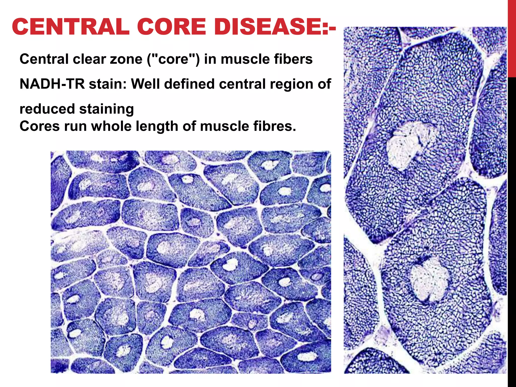 Muscle biopsy –INDICATIONS, processing and morphology.pptx