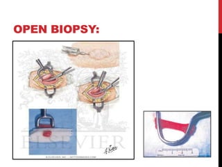 Muscle biopsy –INDICATIONS, processing and morphology.pptx