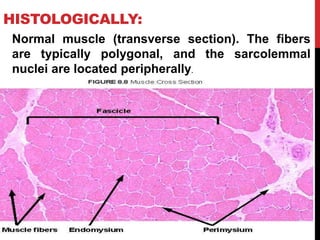 Muscle biopsy –INDICATIONS, processing and morphology.pptx