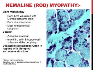 Muscle biopsy –INDICATIONS, processing and morphology.pptx