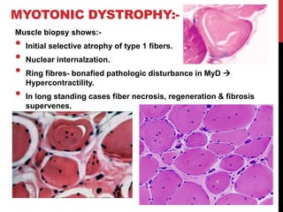 Muscle biopsy –INDICATIONS, processing and morphology.pptx