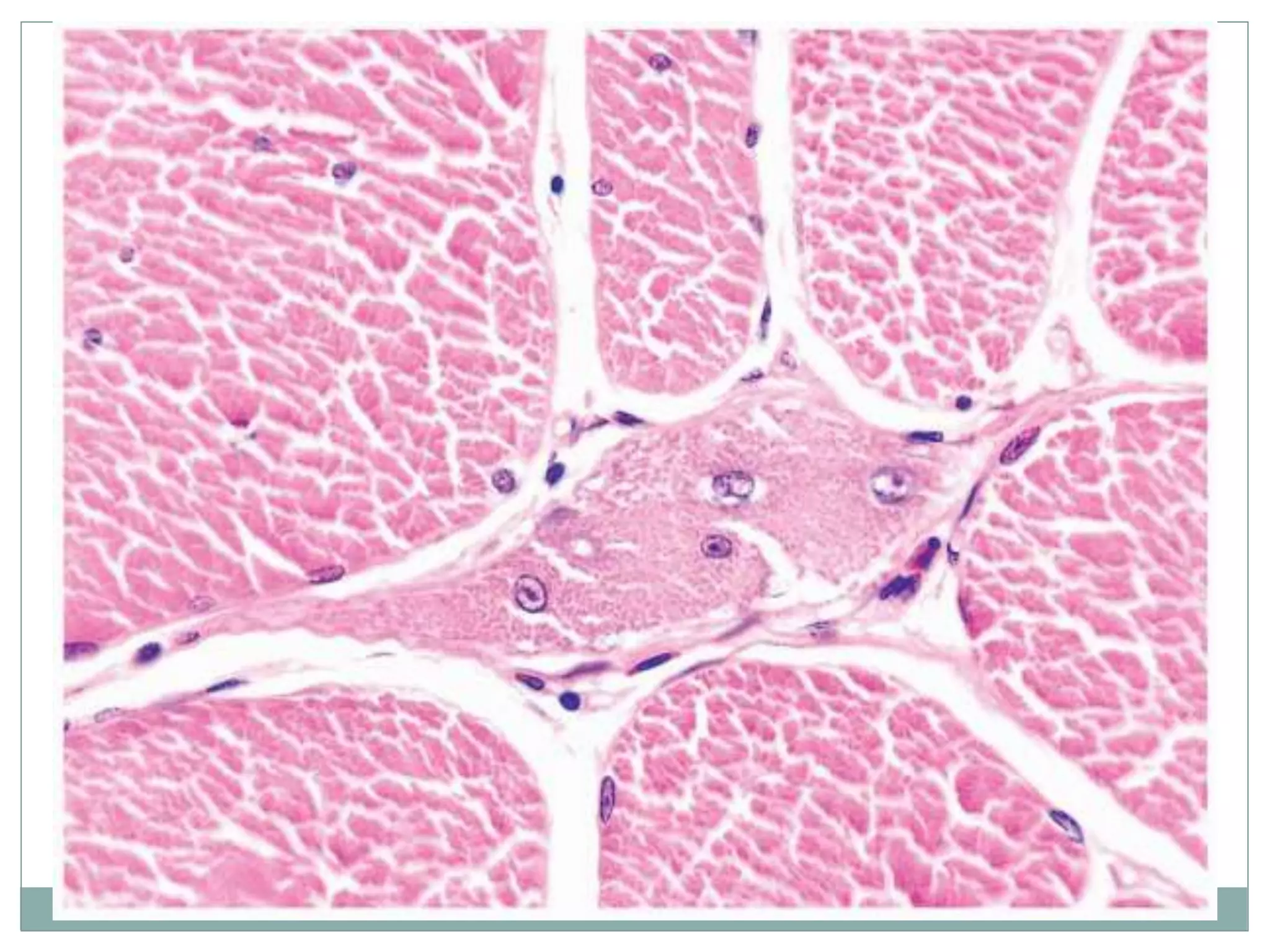 Muscle biopsy interpretation | PPTX