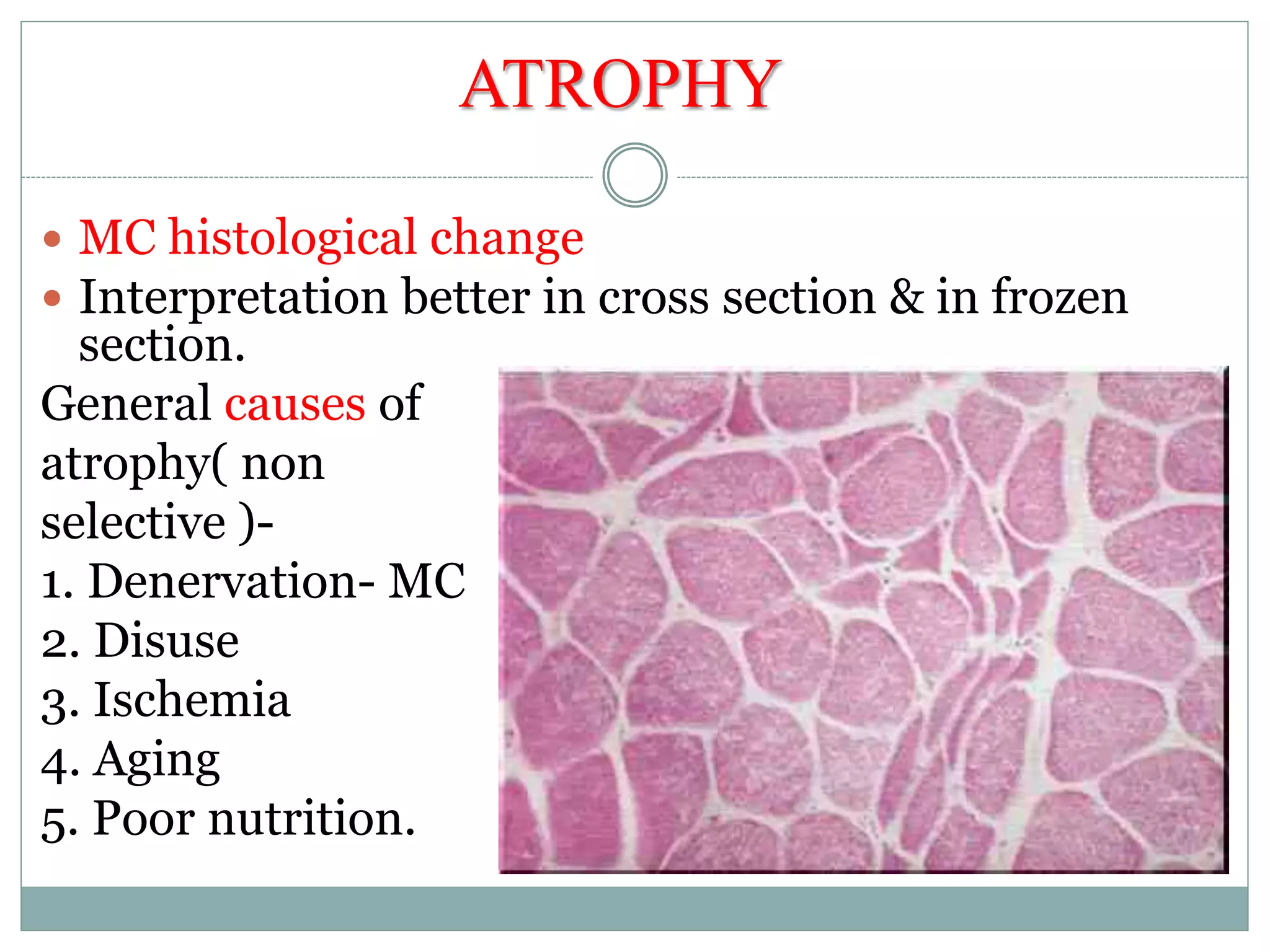 Muscle biopsy interpretation | PPTX