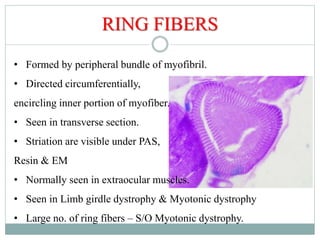 Muscle biopsy interpretation | PPTX