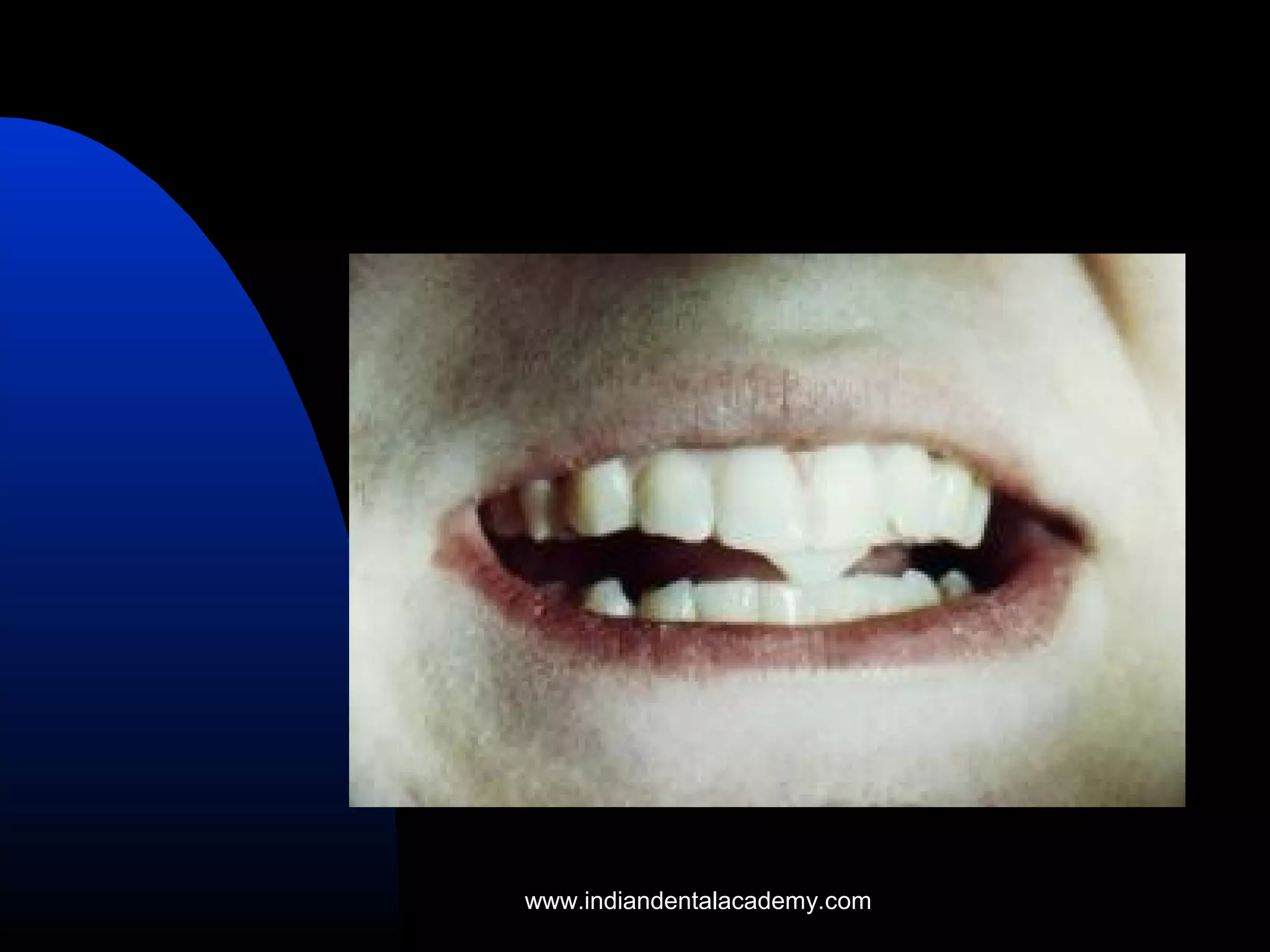 Muscle deprogramming /certified fixed orthodontic courses by Indian ...