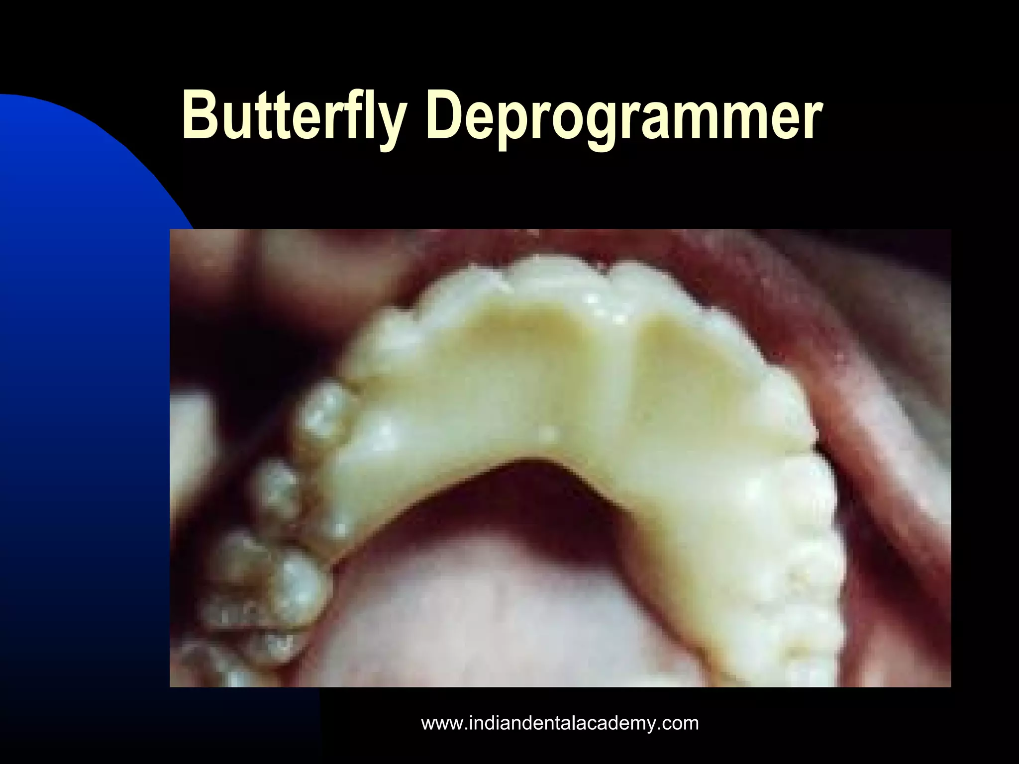 Muscle deprogramming /certified fixed orthodontic courses by Indian ...