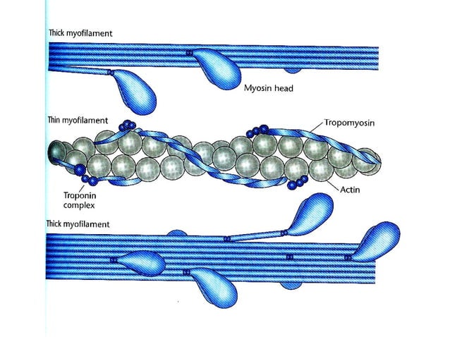 Muscle diseases brief explanation-06.ppt