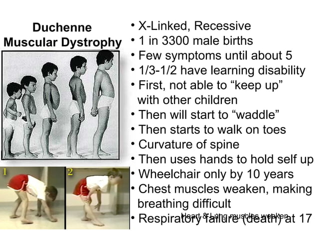 Muscle diseases brief explanation-06.ppt