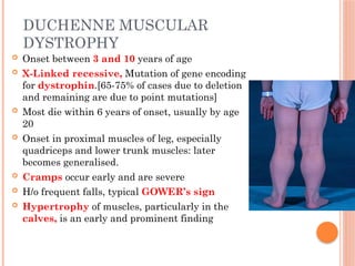 Muscle dystrophies and Approach to muscle disease.pptx