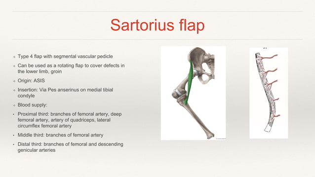 Muscle flaps and their blood supply.pptx | Death, Injury, or Military ...