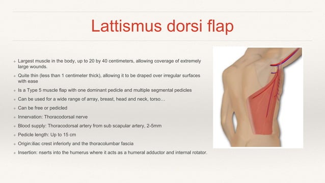 Muscle flaps and their blood supply.pptx | Death, Injury, or Military ...